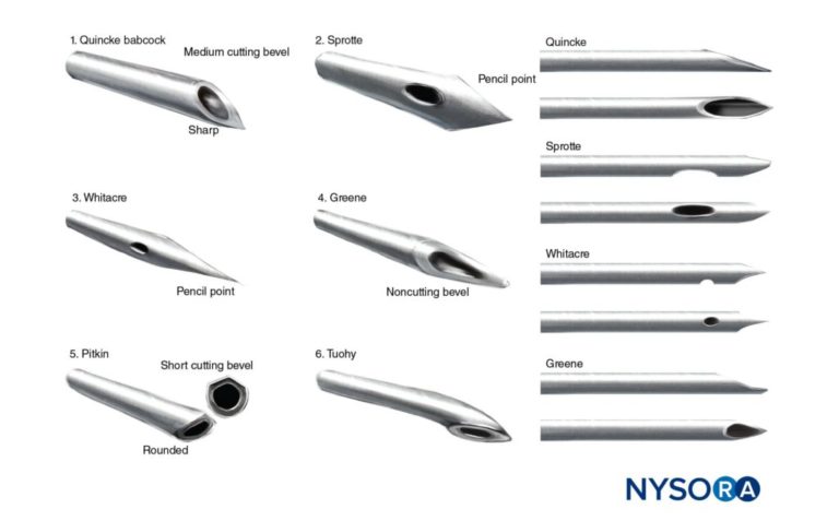 Spinal Anesthesia - NYSORA | NYSORA