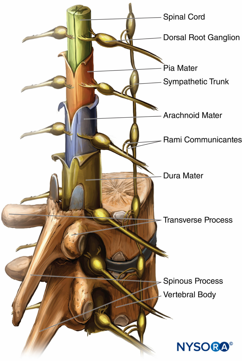 Spinal Anesthesia - NYSORA