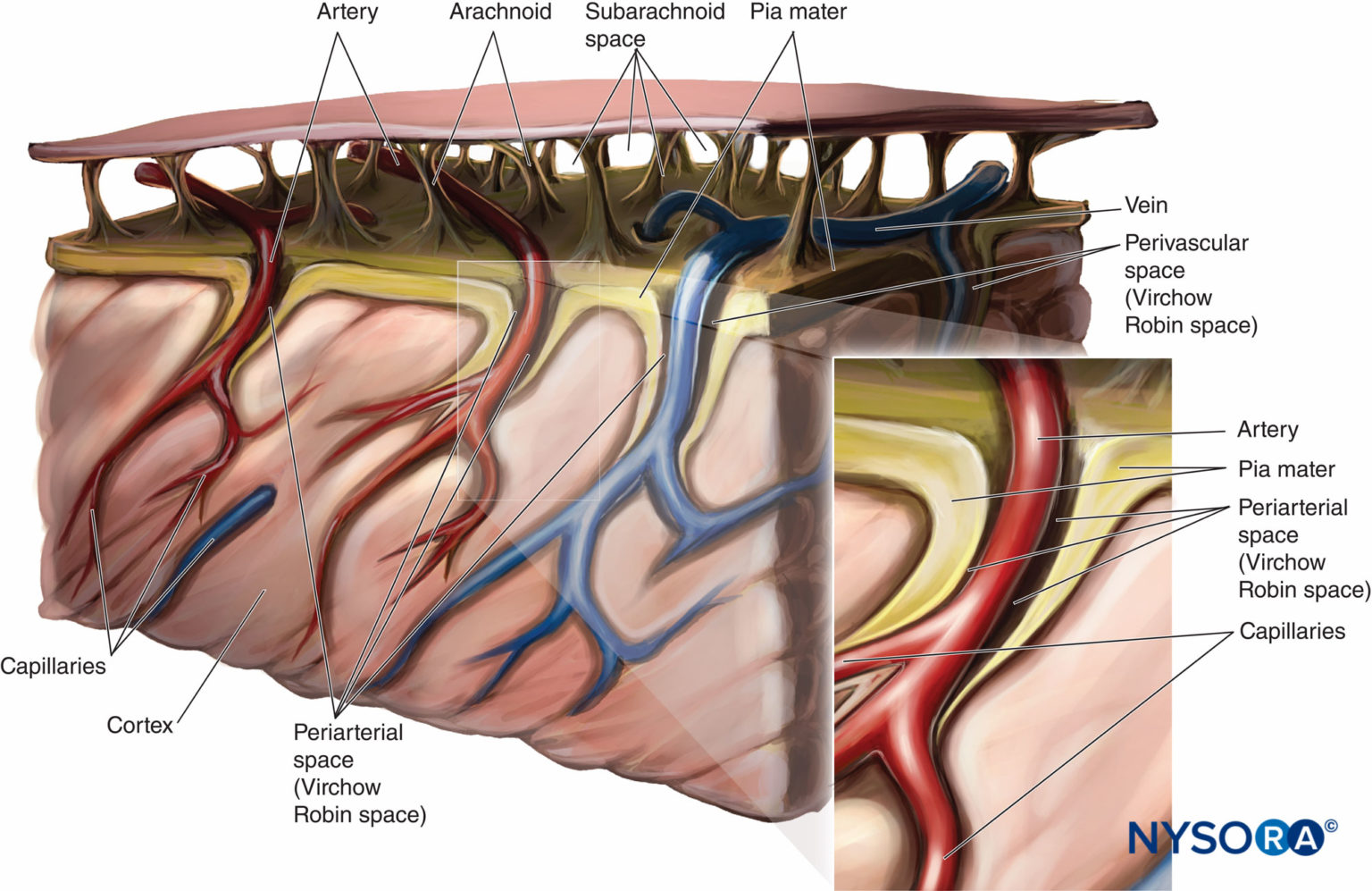 Spinal Anesthesia - NYSORA