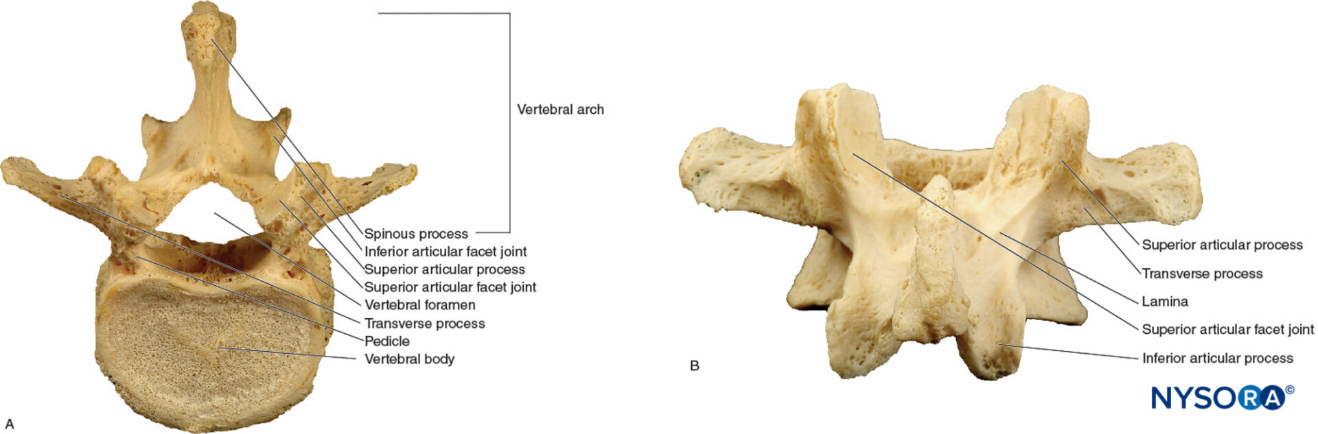 Typical Vertebra