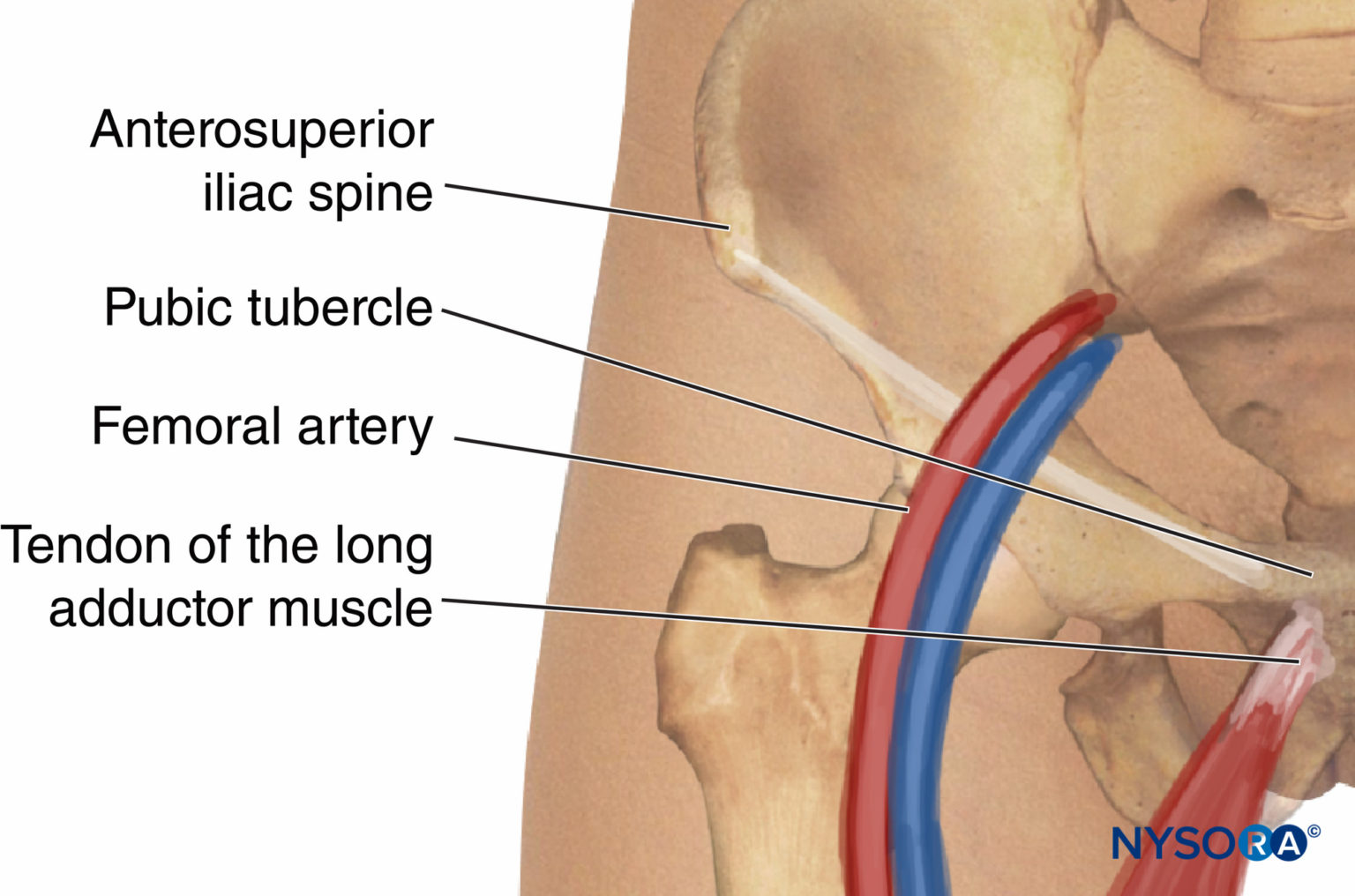 Obturator Nerve Block Landmarks And Nerve Stimulator Technique Nysora