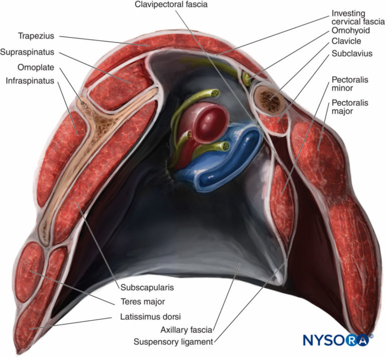 Pectoralis and Serratus Plane Nerve Blocks - NYSORA
