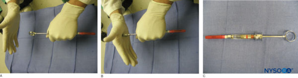 Orale und maxillofaziale Regionalanästhesie - NYSORA