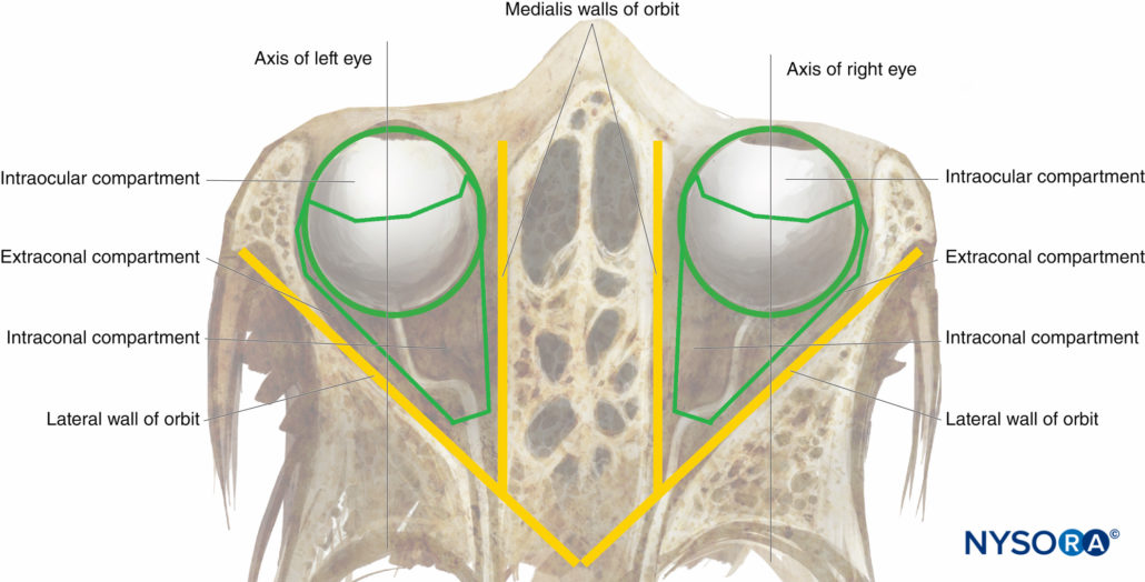 Local and Regional Anesthesia for Ophthalmic Surgery - NYSORA