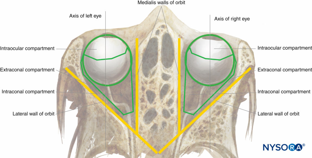 Local and Regional Anesthesia for Ophthalmic Surgery - NYSORA