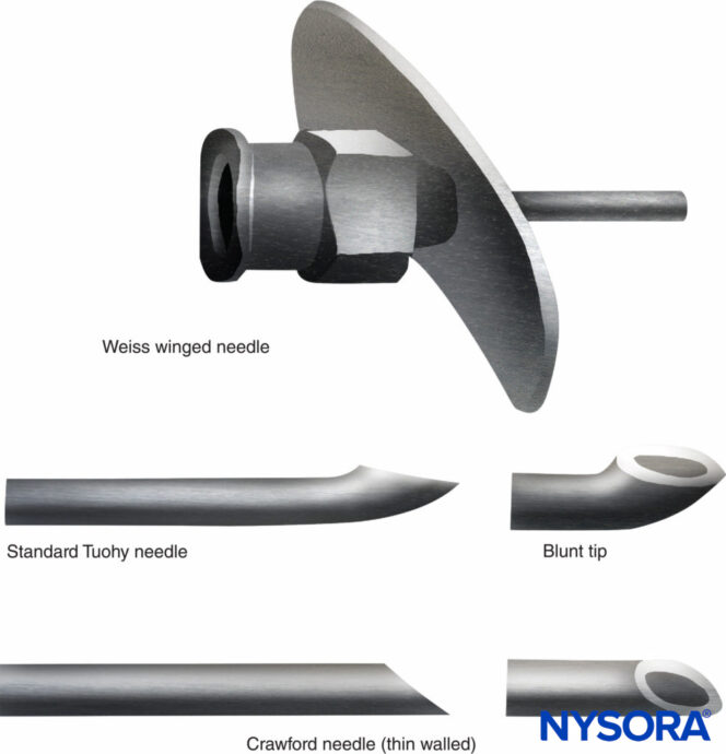 Epidural Anesthesia and Analgesia - NYSORA