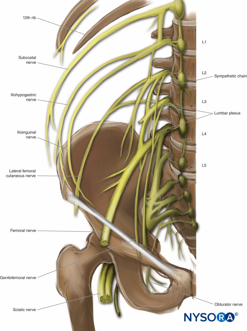 Lumbar Plexus Block