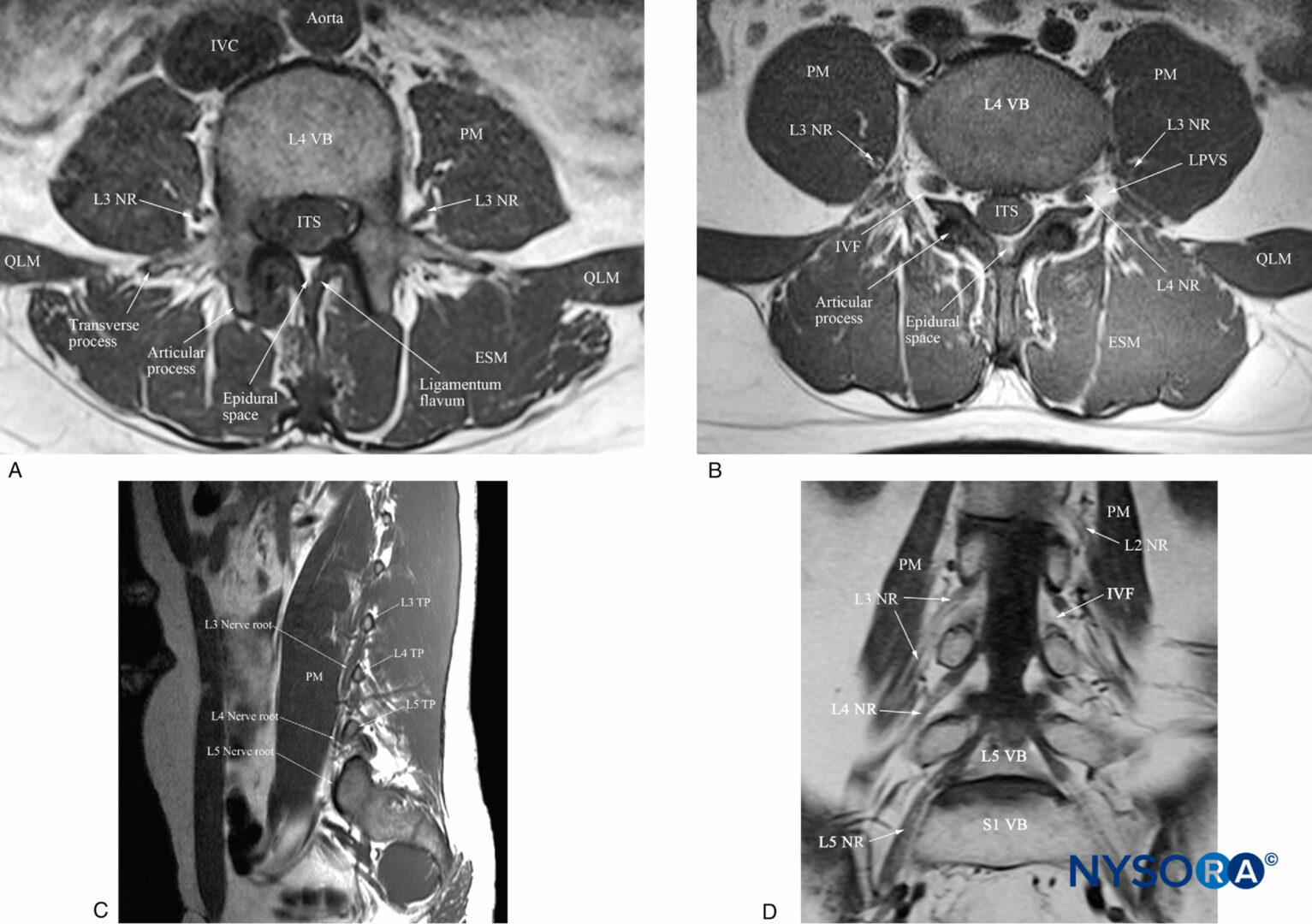 regional-anesthesia-multiplanar-T1-weighte-MRI-images-with-anatomical ...