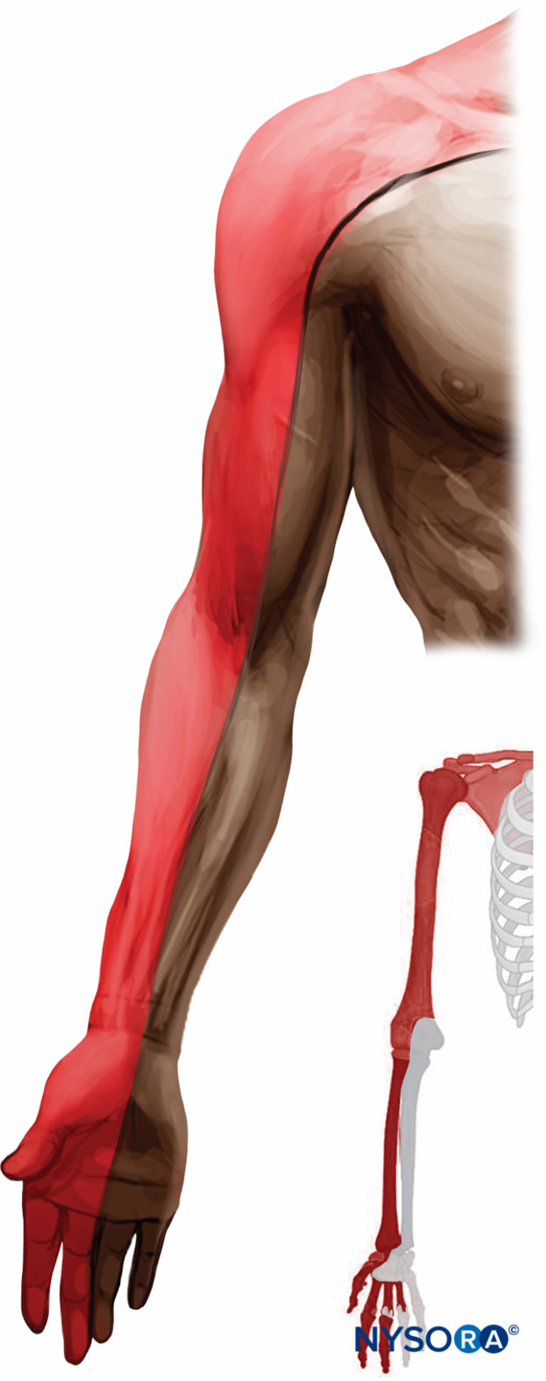 Ultrasound-Guided Interscalene Brachial Plexus Nerve Block - NYSORA