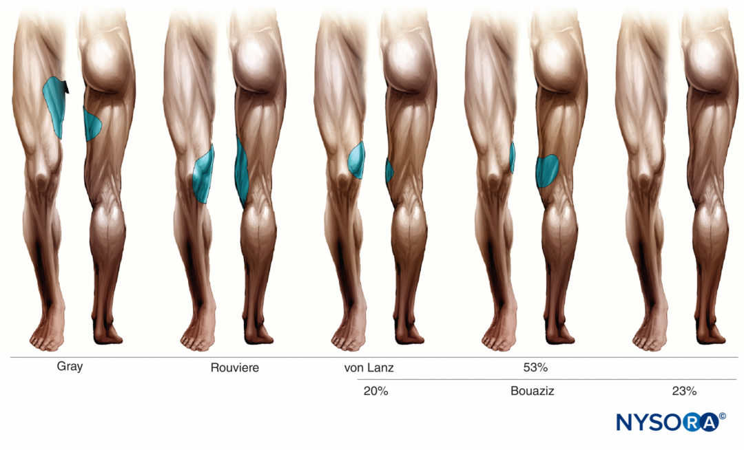 Obturator Nerve Block Landmarks And Nerve Stimulator Technique Nysora