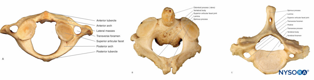 Neuraxial Anatomy - NYSORA
