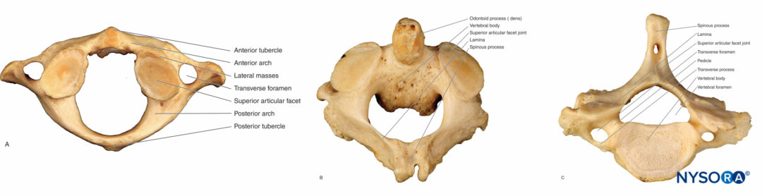 Neuraxial Anatomy - NYSORA | NYSORA