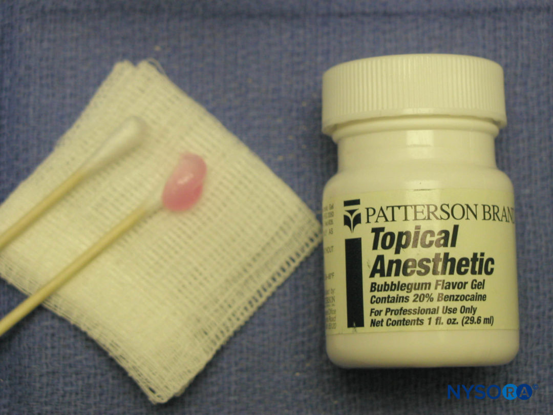 Oral & Maxillofacial Regional Anesthesia - NYSORA