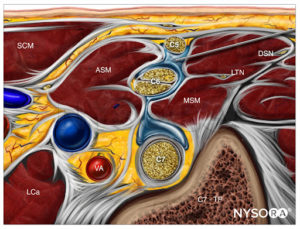 Ultrasound-Guided Interscalene Brachial Plexus Nerve Block - NYSORA