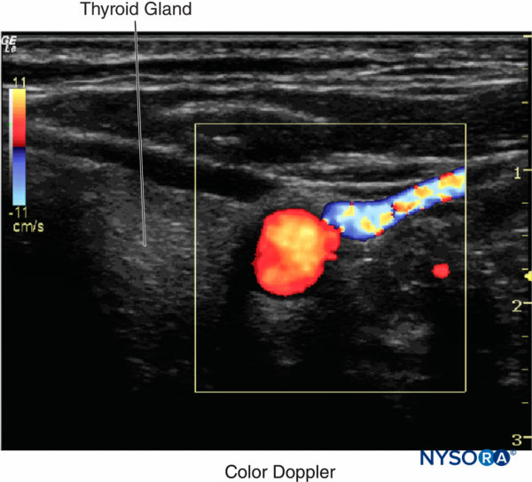 Physics of Ultrasound - NYSORA