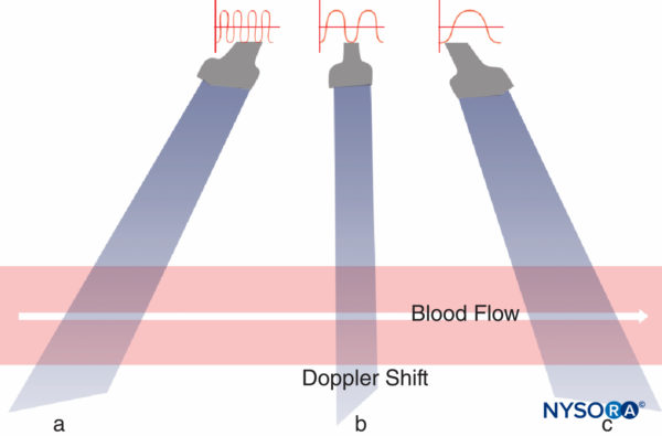 Physics of Ultrasound - NYSORA