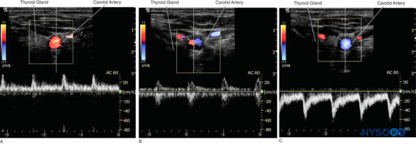 Physics of Ultrasound - NYSORA