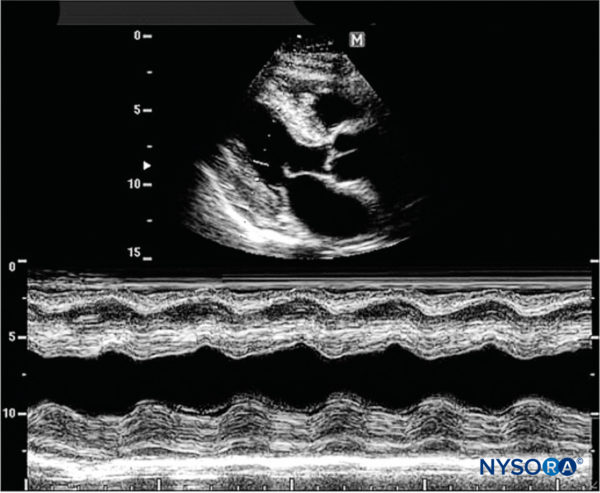 Physics of Ultrasound - NYSORA