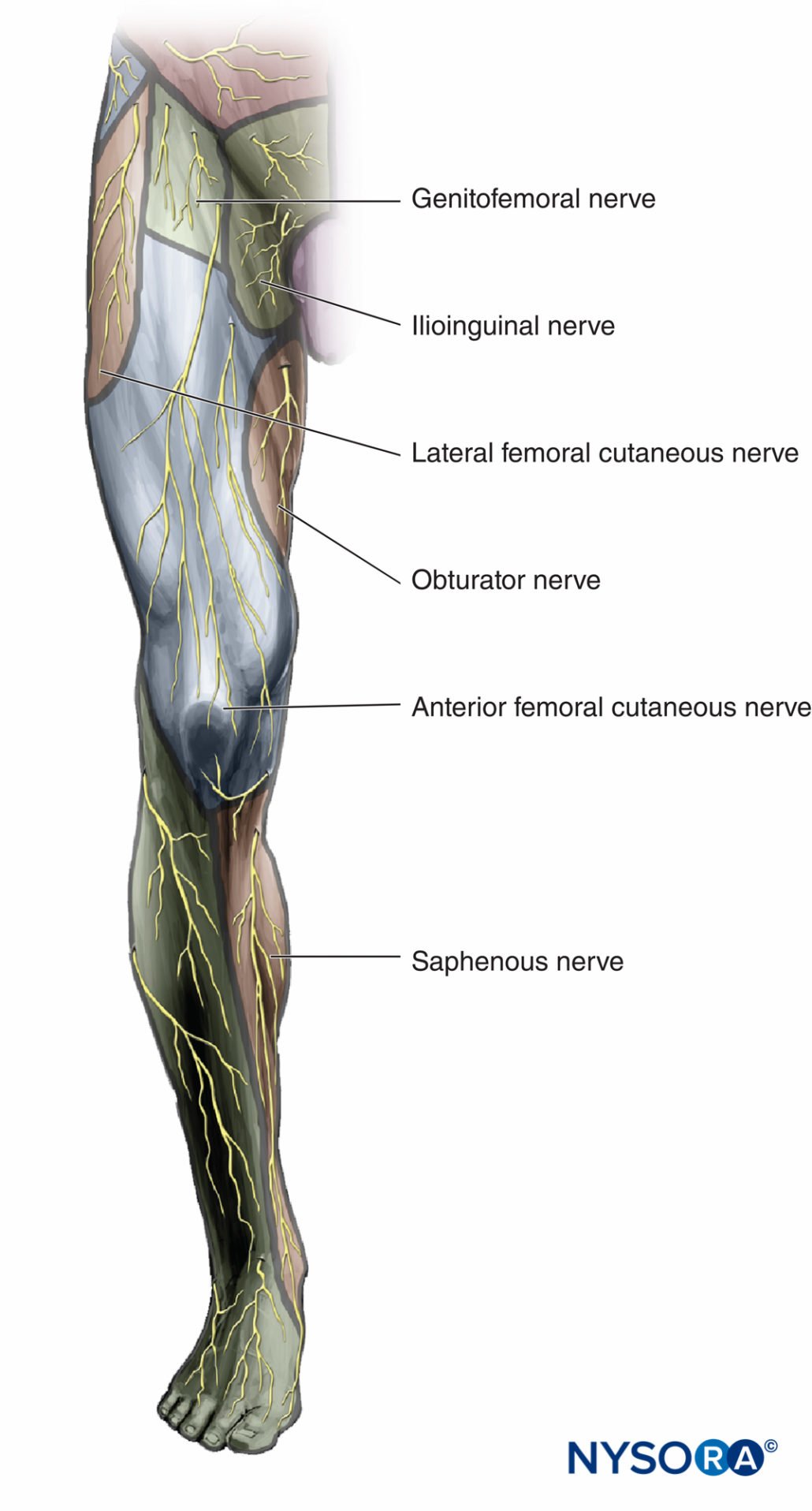 Bloqueo del plexo lumbar - Técnica de estimulación nerviosa y puntos de ...
