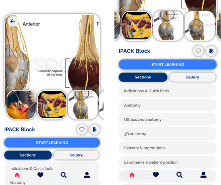 NYSORA Nerve Blocks App New Update - New Design and Image Gallery