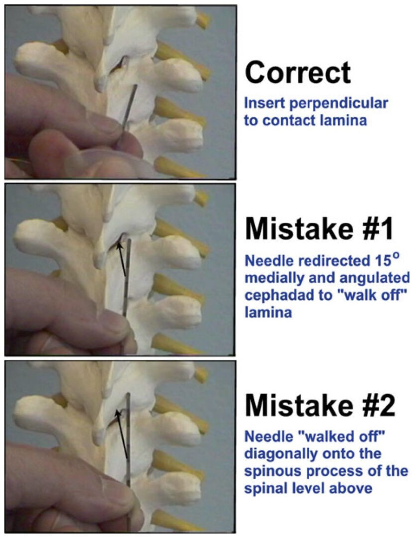 Pediatric Atlas of Ultrasound and Nerve Stimulation-Guided Regional ...