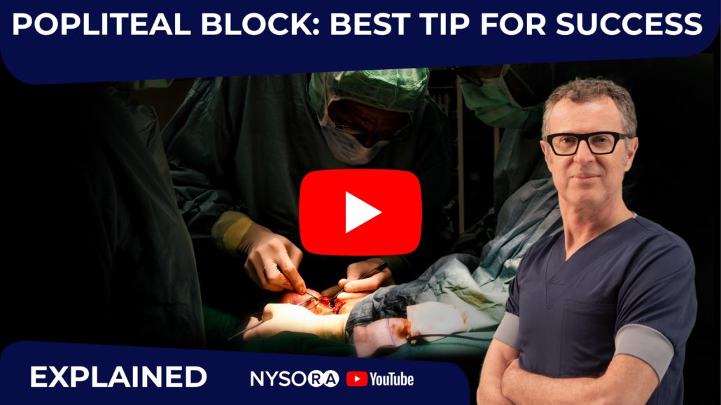 New Crash Course: Popliteal Block Tips For Success - NYSORA