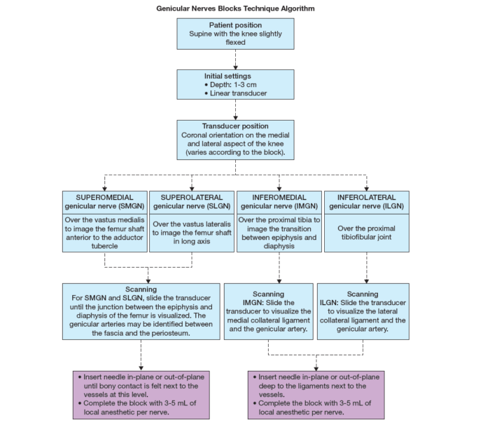 Blocs nerveux géniculaires - NYSORA