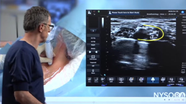 Anesthesia for Rotator Cuff Repair - NYSORA