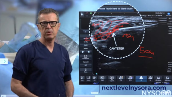 Anesthesia for Rotator Cuff Repair - NYSORA