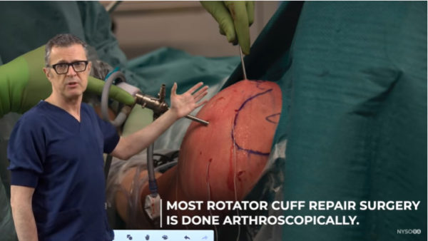 Anesthesia for Rotator Cuff Repair - NYSORA