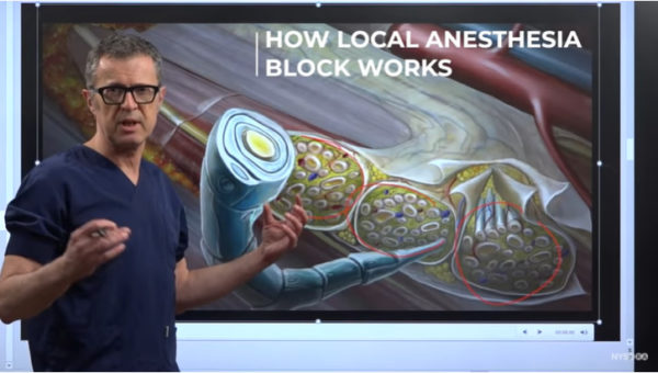 Anesthesia for Rotator Cuff Repair - NYSORA