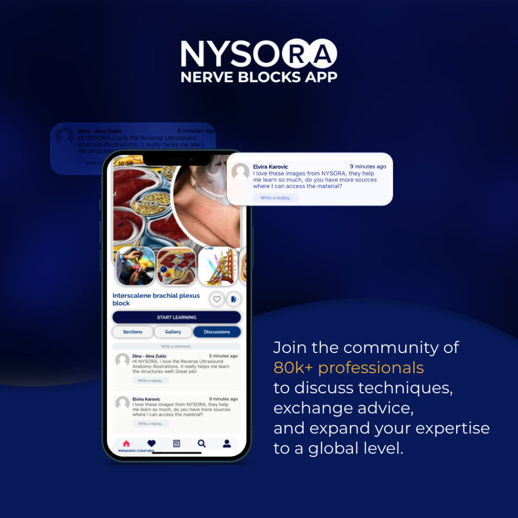 NYSORA’s Nerve Blocks app has released an all-new feature - NYSORA