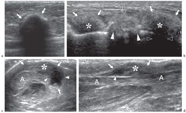 Piel y Tejido Subcutáneo - NYSORA
