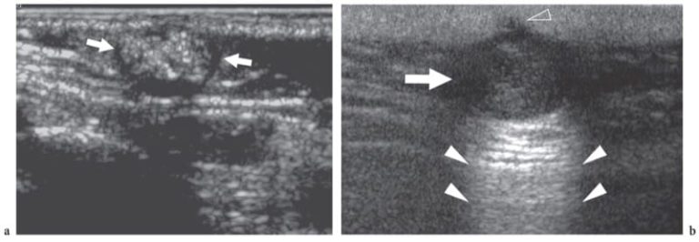 Skin and Subcutaneous Tissue - NYSORA