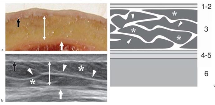 Skin and Subcutaneous Tissue - NYSORA