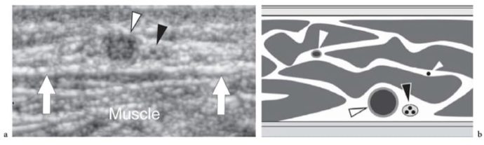 Skin and Subcutaneous Tissue - NYSORA
