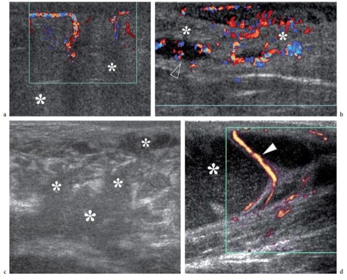 Skin and Subcutaneous Tissue - NYSORA