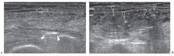 Skin and Subcutaneous Tissue - NYSORA