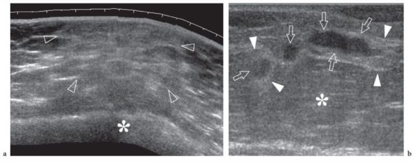 Skin and Subcutaneous Tissue - NYSORA