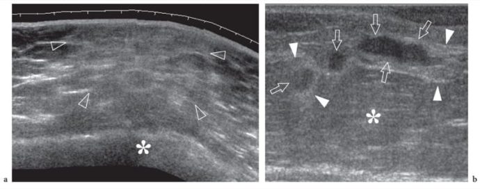 Skin and Subcutaneous Tissue - NYSORA
