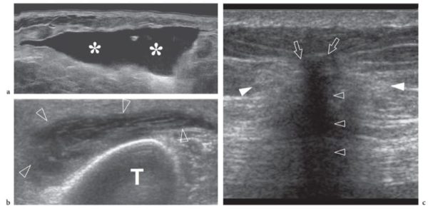Peau et tissus sous-cutanés - NYSORA