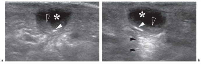 Piel y Tejido Subcutáneo - NYSORA