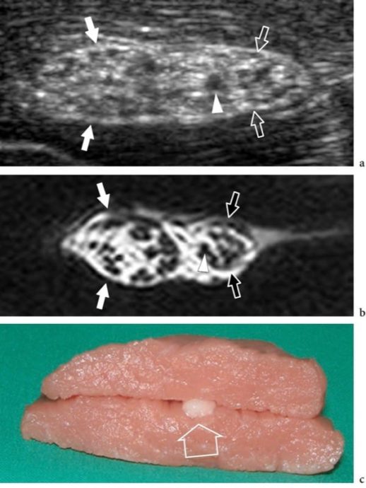 Nerve and Blood Vessels - NYSORA