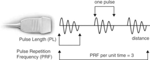Basics of Ultrasound: Pitfalls and Limitations - NYSORA