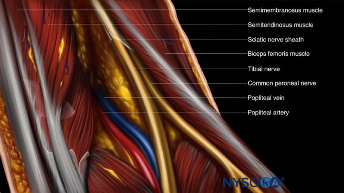 Ultrasound-Guided Nerve Blocks of the Lower Limb - NYSORA