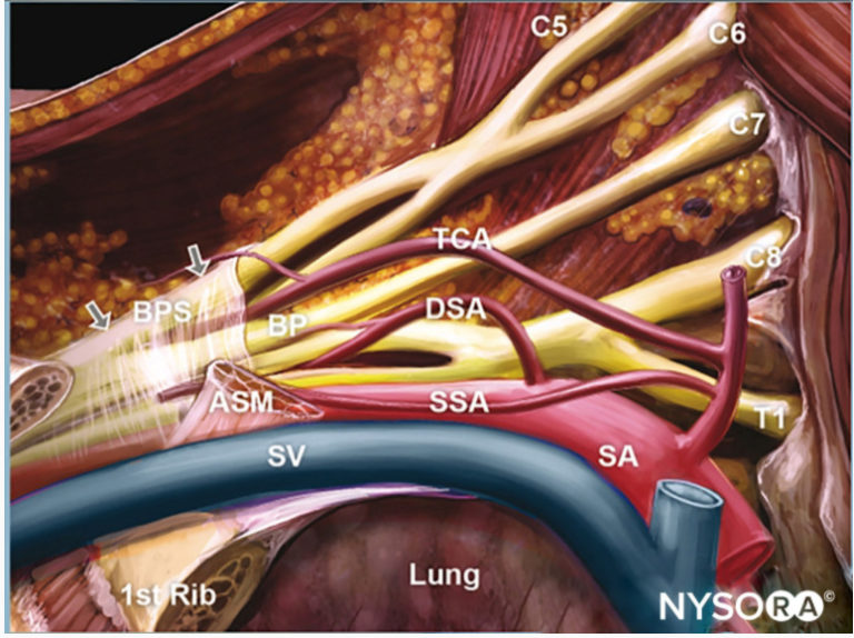 Ultrasound-Guided Upper Extremity Blocks - NYSORA