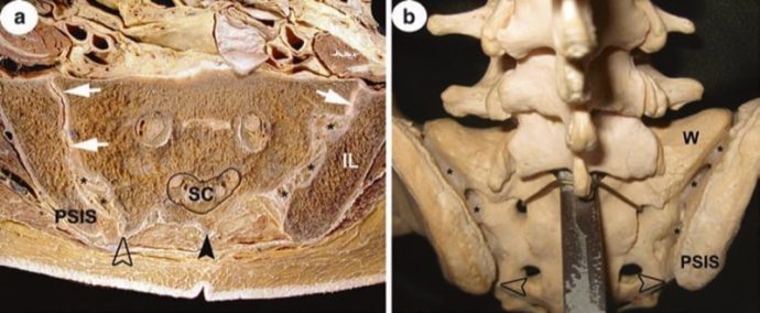 Sonoanatomía de la columna vertebral para médicos del dolor - NYSORA