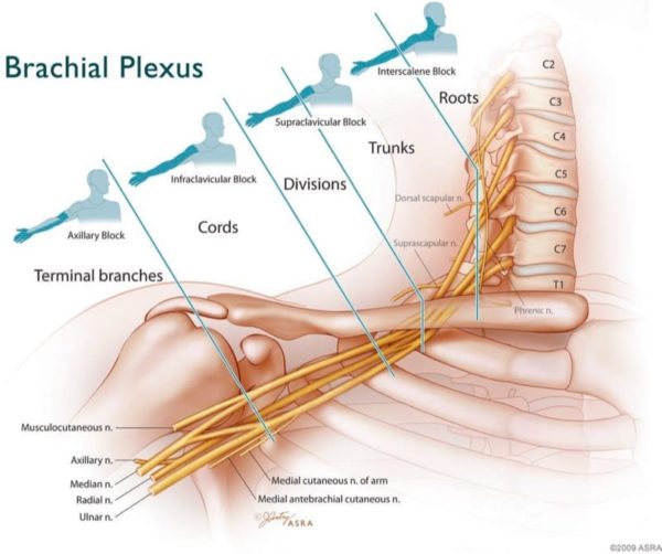 Ultrasound-Guided Upper Extremity Blocks - NYSORA