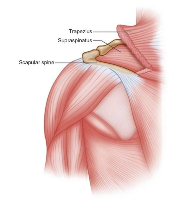 Ultrasound-Guided Peripheral Nerve block in Chronic Pain Management ...