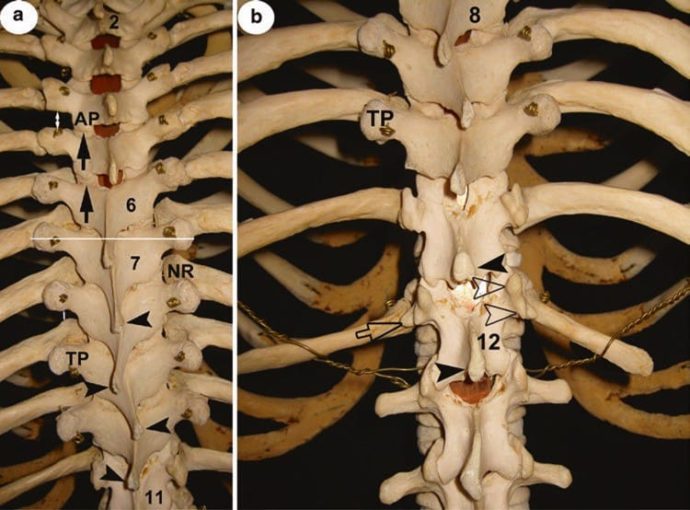 Spine Sonoanatomy for Pain Physicians - NYSORA